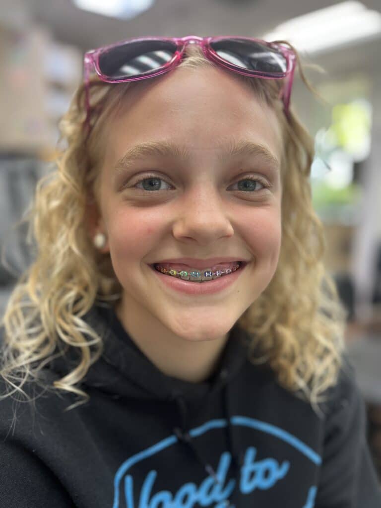 The Ultimate Guide To Picking Beautiful Braces Colors - Ohana ...